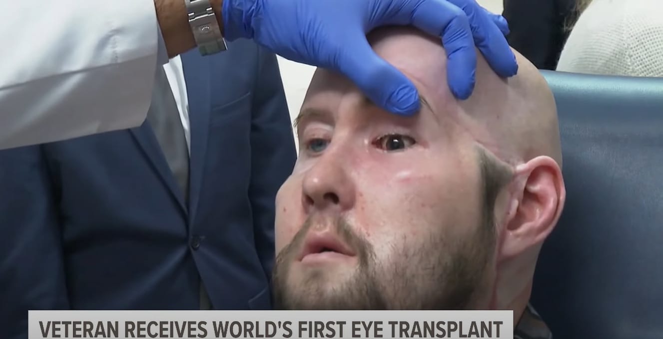 New York Hospital Performs World’s First Whole-Eye And Partial Face ...